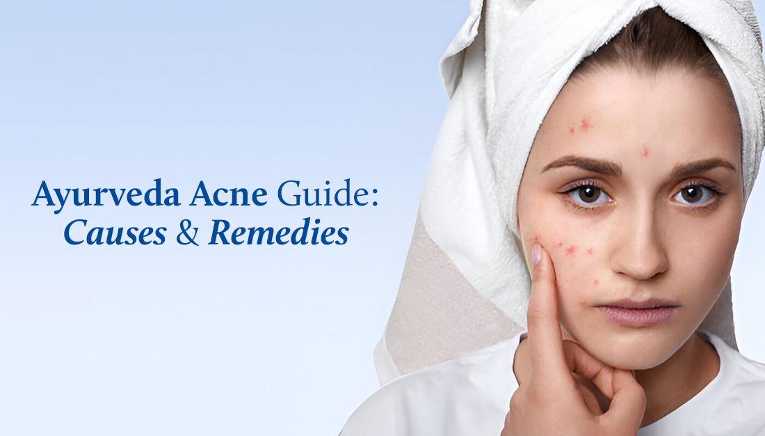 Acne Causes & Treatment: A Guide to Spotless Skin – Blue Nectar