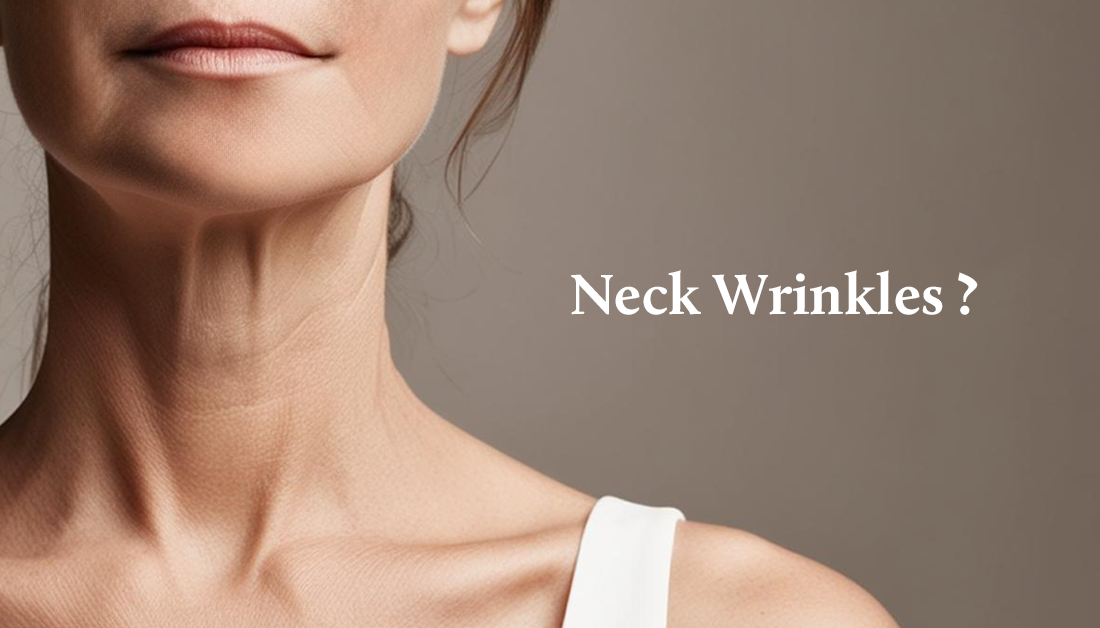 Neck Wrinkles: Causes, Prevention, and Skincare Tips – Blue Nectar