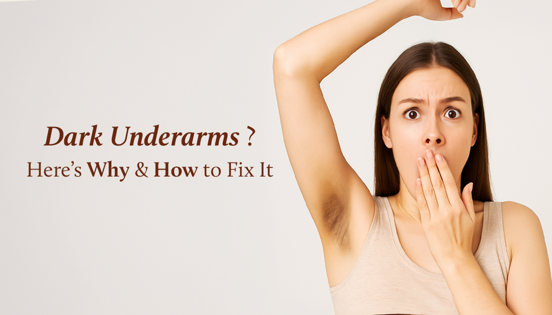 Dark Underarms: Causes, Natural & Chemical Treatments – Blue Nectar